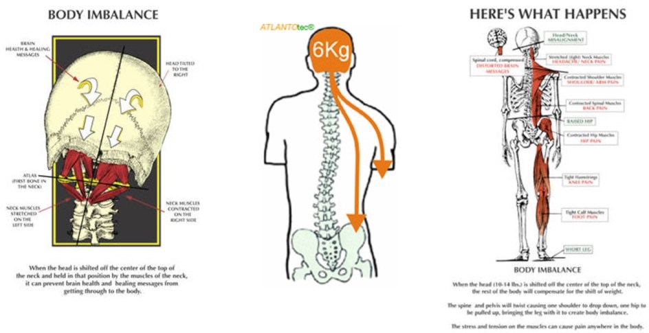 tmj causes dystonia | Cure for Dystonia
