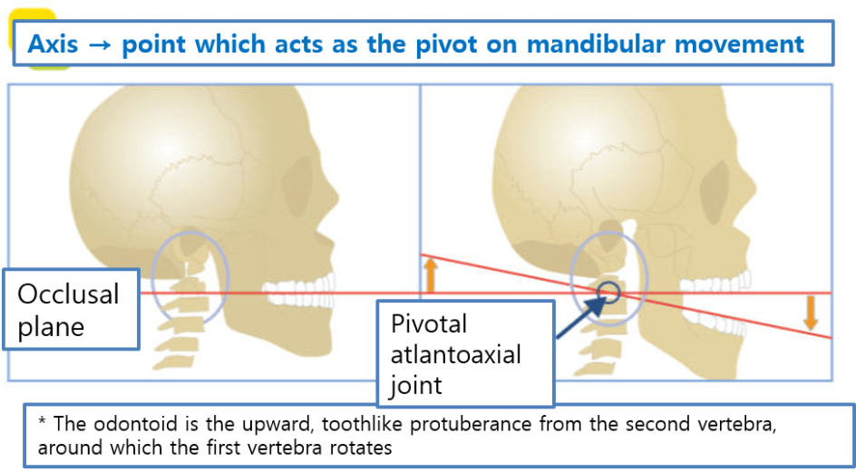 tmj causes dystonia | Cure for Dystonia